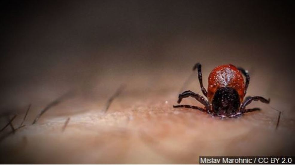 Tick removed from Kentucky man's eye | WZTV